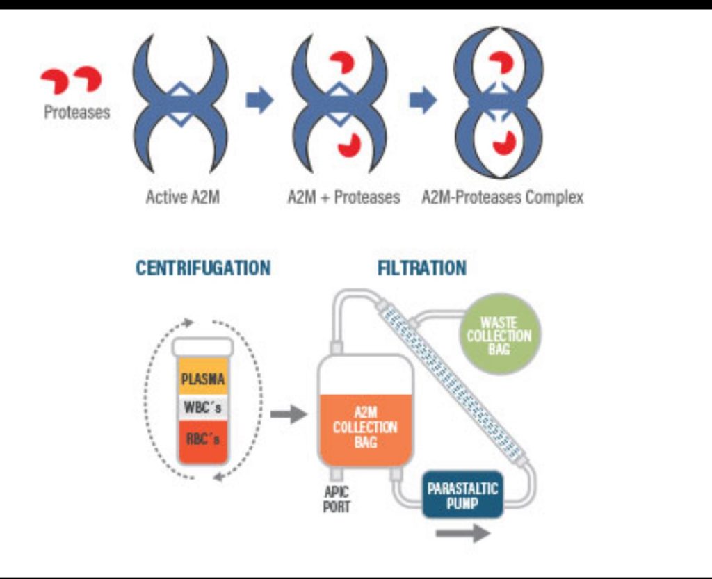 A2M Therapy- Alpha-2-Macroglobulin (A2M) in Napa, CA | Napa Integrated ...